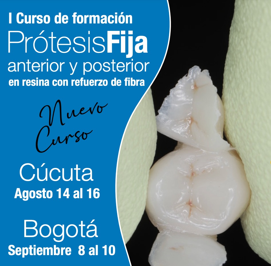 Prótesis fija anterior y posterior en resina con refuerzo de fibra ...